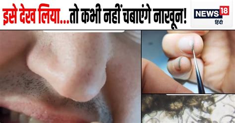 नाखून चबाना इतना खतरनाक Video देखकर आप भी कहेंगे क्यों बुजुर्ग कहते थे