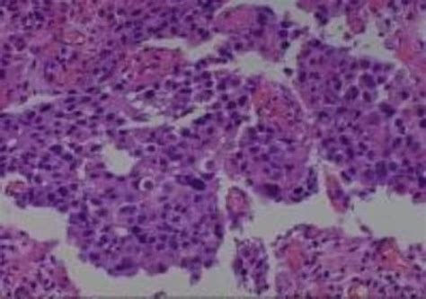 Novus Biologicals™ Human Multi Tissue Tissue Microarray Cancer Human