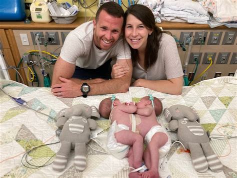 Conjoined Twins Separated By Ben Carson
