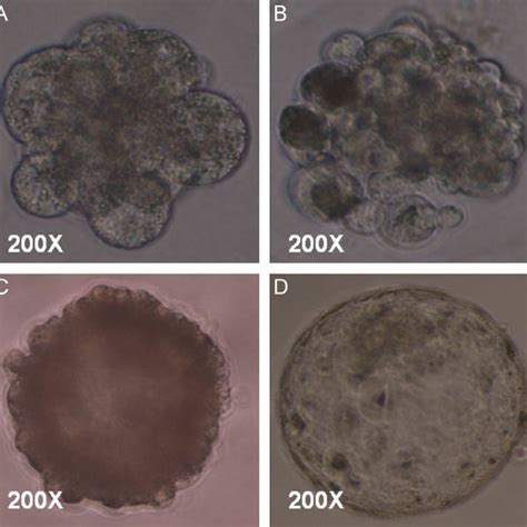 Sexing Of Embryos Using Amelogenin Gene Amplified Amelogenin Gene