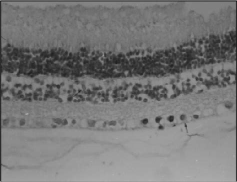 Figure 1 From A Short Duration Transient Ischemia Induces Apoptosis In Retinal Layers An