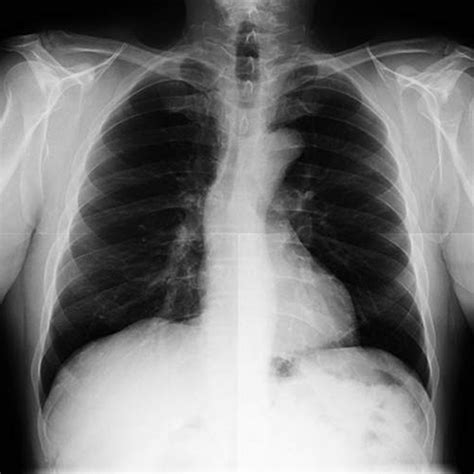 Calibration Artifact At Sabrina Evans Blog