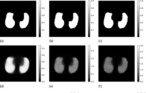 Figure 1 From A Data And Knowledge Driven Approach For Spect Using