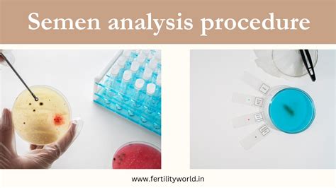 Semen Analysis Test Cost Fertilityworld