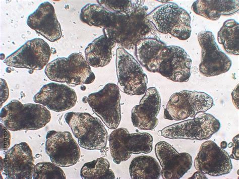 Protoscolices Echinococcus Multilocularis Microscopic Photo Of Being Released From A Larvacyst