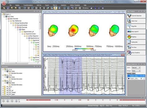 Brainvision Analyzer Brain Products Gmbh Solutions