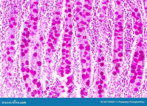 Small Intestine Duodenum And Vermiform Appendix Human Under The Microscope Stock Image Image