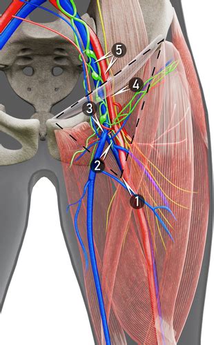 Terms Definitions And Measurements To Describe Sonographic Features Of