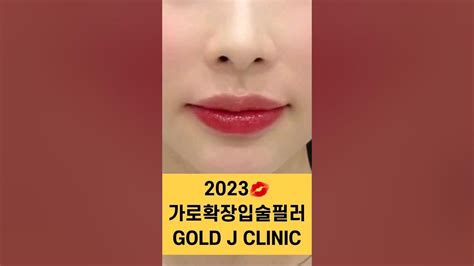 💋2023 가로확장입술필러 에프터 컬렉션 ️24년도 많이 기대해주세용 Youtube