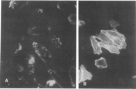 Fluorescence Micrographs Showing Hep 2 Cells Infected With Eaf And