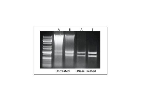 How Can I Successfully Remove Genomic Dna Contamination From My Rna