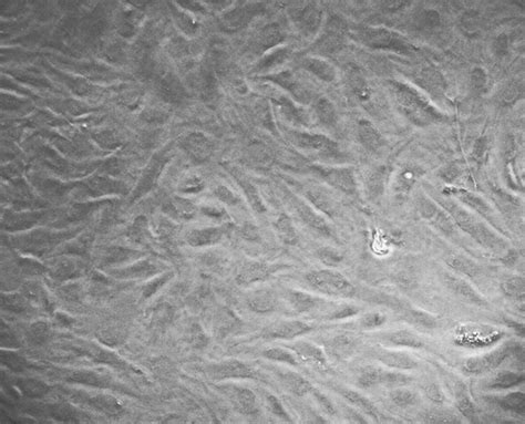 Representative Morphology Of The Cultured Porcine Keratocytes At Download Scientific Diagram
