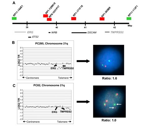 Figuur 2 Figure 2 Array Based Cgh Analysis Of Chromosome 21 And Download Scientific Diagram