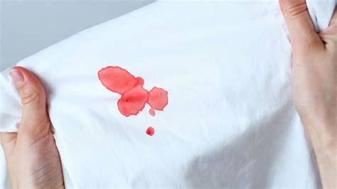 Tres Trucos Infalibles Para Sacar Las Manchas De Sangre Secas Mdz Online