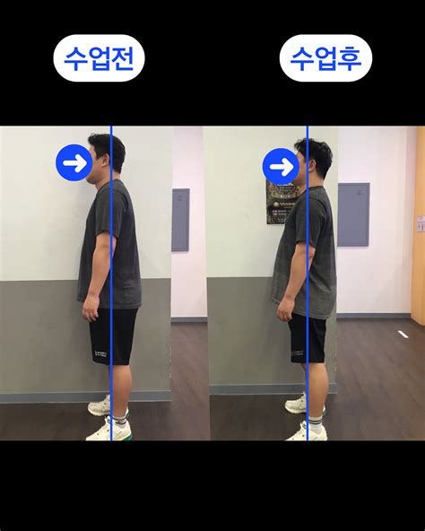 스포벡휘트니스 회기점 전환규 20대 건축학과 여성회원님 ️ ️가슴 앞쪽은 굳어 있고 ️ 어깨는 안으로 말려 있고 ️ 전체적인