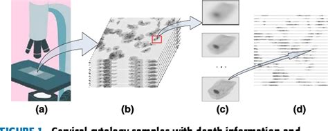 Figure 1 From Nucleus Segmentation Of Cervical Cytology Images Based On Depth Information