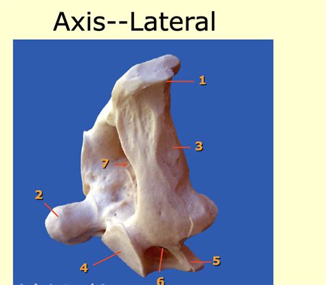 Axis Lateral Diagram Quizlet