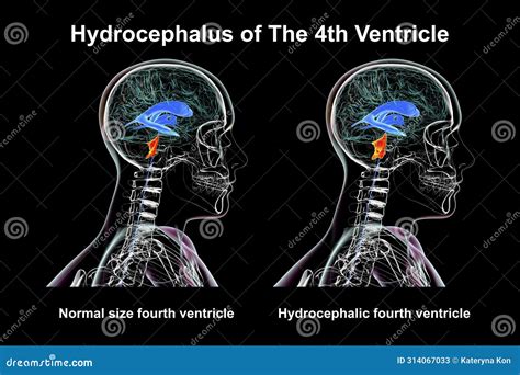The Fourth Brain Ventricle D Illustration Royalty Free Cartoon CartoonDealer Com
