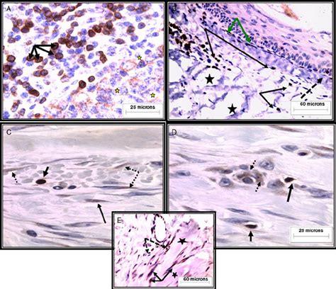 A Control Section From Spleen To Show Cd T Lymphocyte Black Download Scientific Diagram