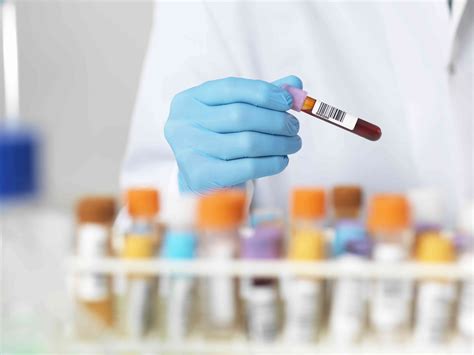 The Meaning Of Pcos Lab Results