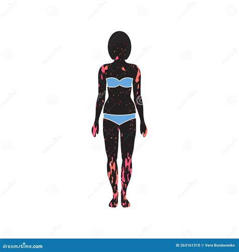 Painful Dermatous Rash On Dark Skinned Female Body Stock Vector