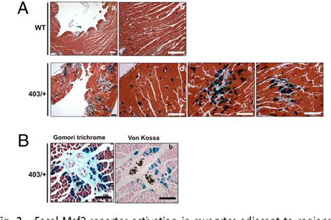 Figure 2 From Heterogeneous Myocyte Enhancer Factor 2 Mef2 Activation