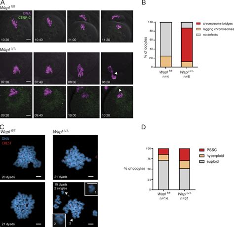 Wapl Depletion Causes Severe Chromosome Segregation Defects In Old Download Scientific Diagram