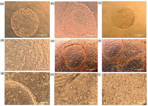 Trophectoderm Cell Culture A Hatched Blastocyst Seeded Onto The Download Scientific Diagram