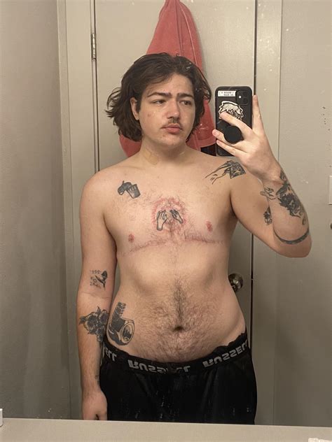 How Bad Is The Hip Situation Ftm Rtranspassing