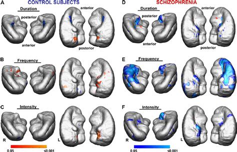 Correlation Maps Showing Associations Between Mismatch Negativity Mmn