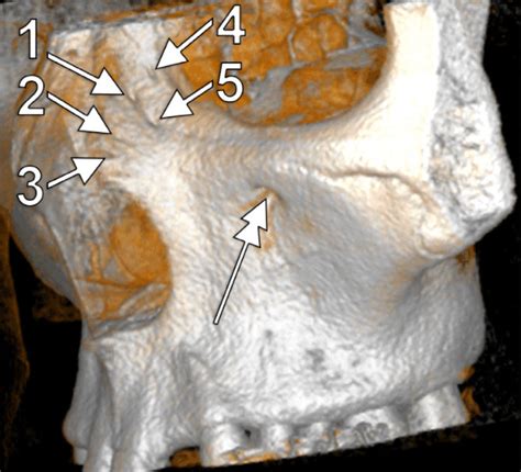 Three Dimensional Volume Renderization Icatvision Software And The Download Scientific