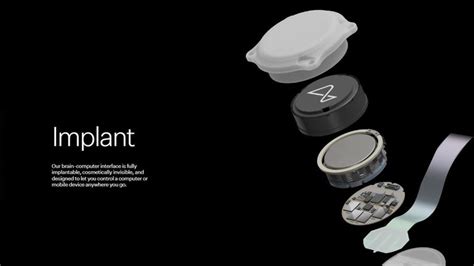 Will Neuralink Enhance Intelligence Abtc