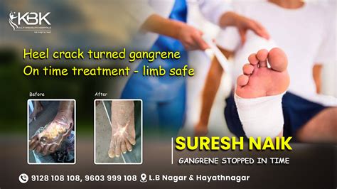 Septic Wound Prevent Severe Complications With Early Care