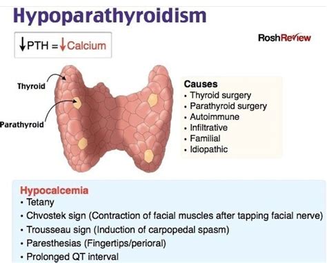 Hypoparathyroidism Medizzy