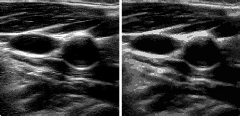 Experimental Results When The Data Smoothing Algorithms Have Been Download Scientific Diagram