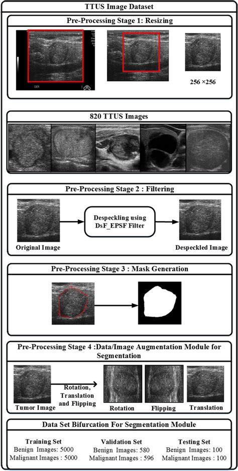 The Steps Adopted For Dataset Preparation For Semantic Segmentation