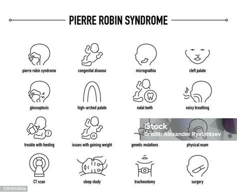 Pierre Robin Syndrome Symptoms Diagnostic And Treatment Vector Icon Set
