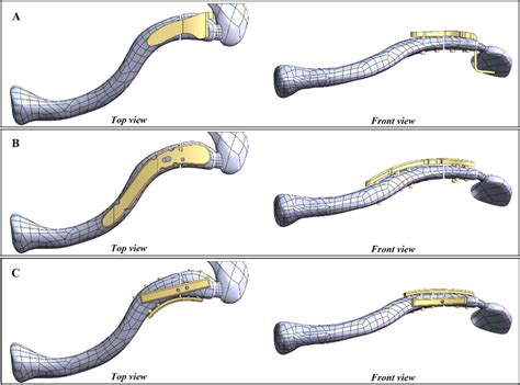 The Top View And Front View Of The Three Fixation Models A Hook Plate