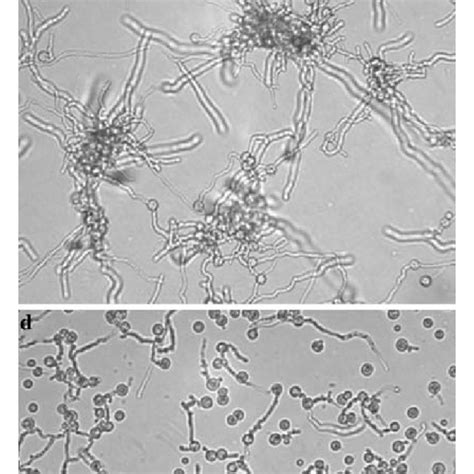 Agglutination Assay Of Trichoderma Atroviride Conidia With A Serial