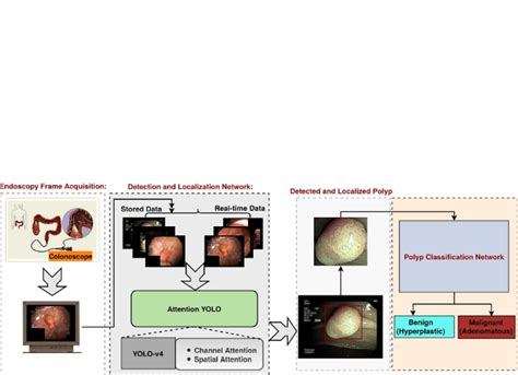 Attention Guided Deep Framework For Polyp Localization And Subsequent
