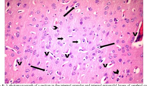 Cerebral Cortex Histology Layers Cerebral Cortex Histology Layers