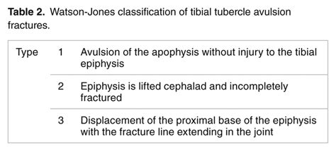 Watson Jones Classification Of Tibial Tubercle Avulsion Fractures
