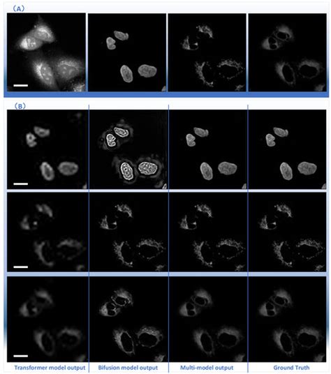 Multiple Parallel Fusion Network For Predicting Protein Subcellular