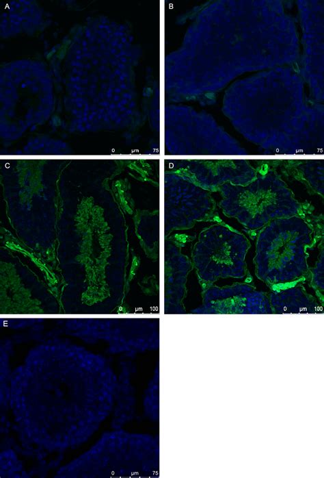 Comparison Of Venus Expression In The Developing Testis Of Sb3jt Download Scientific Diagram