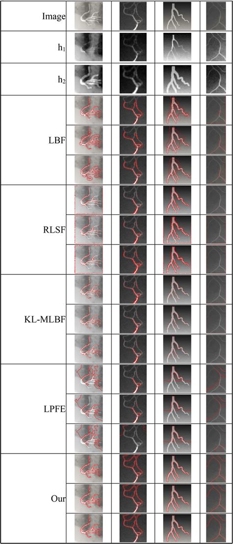 Set Of Comparison Experiments Used To Verify The Robustness Of Our