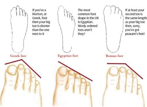 How Can You Tell If You Broke Your Big Toe Broken Toe Symptoms And Causes