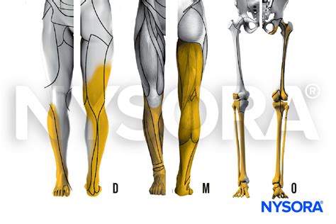 Nerve Block Nysora 360