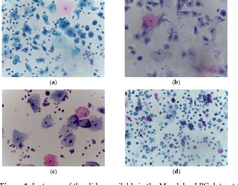 Figure 1 From Cervical Cancer Diagnosis Based On Multi Domain Features Using Deep Learning