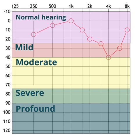 Retaining Employee Hearing Test Records Legal Requirements And Best