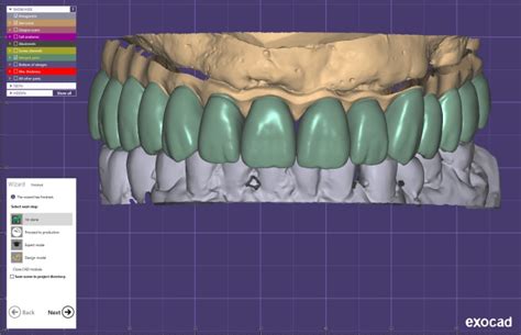 Design In Exocad For Dental By Emiliaorban98 Fiverr